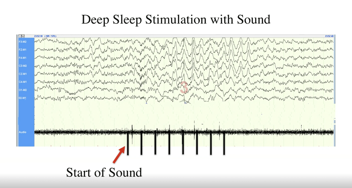 The Science of Sleep & Inducing Deep Sleep - HotDoc
